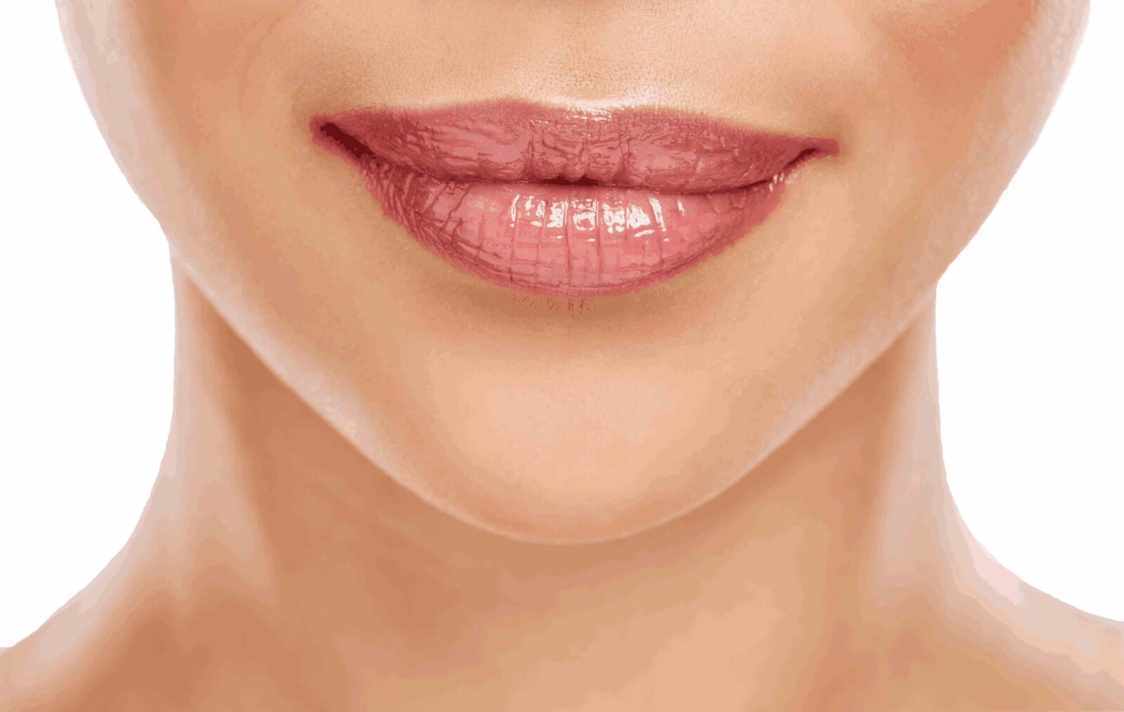 Liplift - Roma